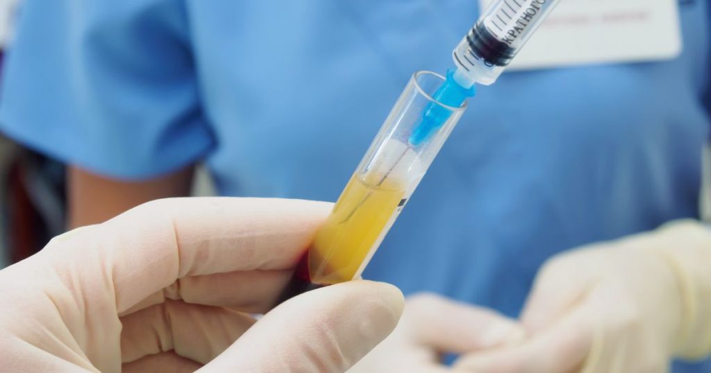 PRP visage prix Turquie- injection prp visage - rajeunissement par soin prp